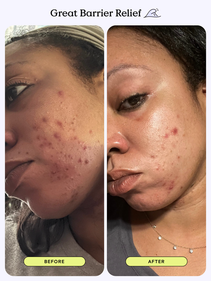 Jumbo Great Barrier Relief: Skin Barrier Restoring Serum – KraveBeauty