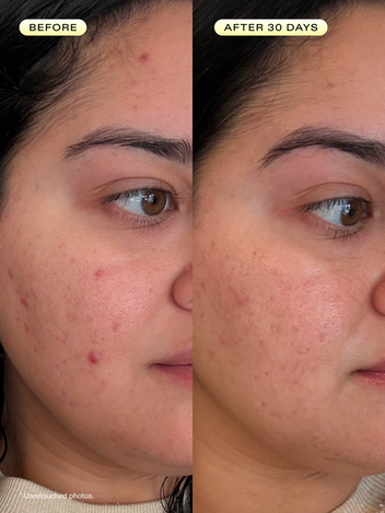 Oil La La – KraveBeauty