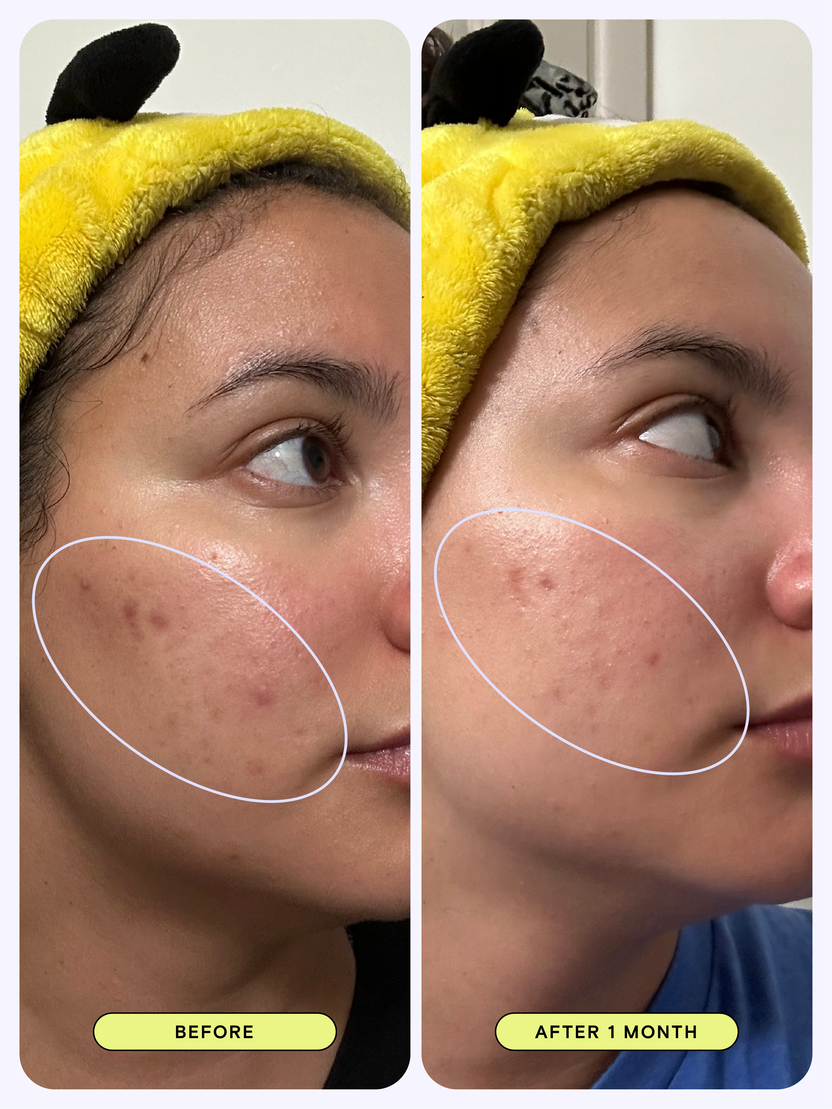 Oil La La – KraveBeauty